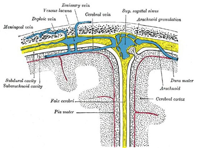 Hemorragia subaracnoidea. – RadiodiagnosticAndo