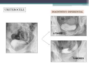 Urografía intravenosa: en qué consiste, para qué se utiliza, cómo se ...