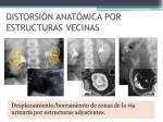 Urografía intravenosa: en qué consiste, para qué se utiliza, cómo se ...