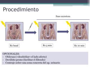 Urografía intravenosa: en qué consiste, para qué se utiliza, cómo se ...