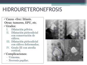 Urografía intravenosa: en qué consiste, para qué se utiliza, cómo se ...